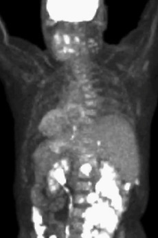 ‎invisible 2023 (2024) directed by Grahame Weinbren • Reviews, film ...