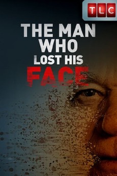 ‎The Man Who Lost His Face (2011) directed by Christopher Barnes • Film ...