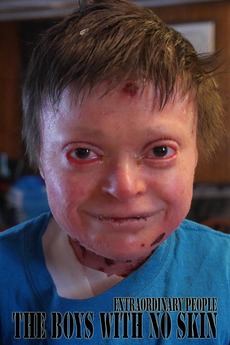 ‎Extraordinary People: The Boys With No Skin directed by Danny Beck ...